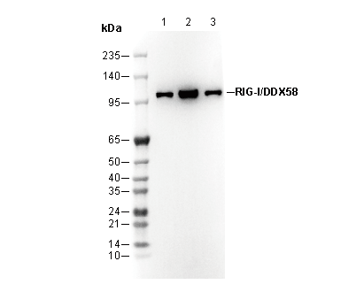RIG-I / DDX58 Antibody [H1P18] | Primary Antibodies