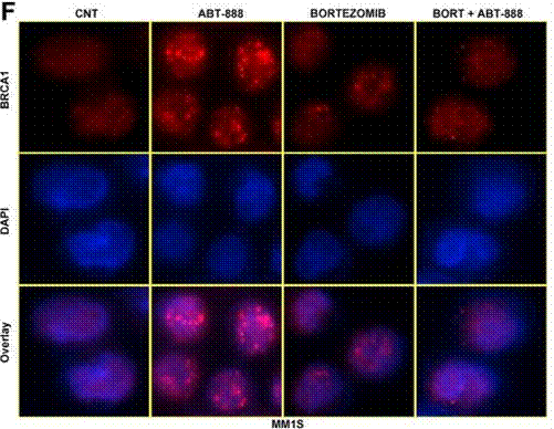 Veliparib (ABT-888) | PARP inhibitor | Mechanism | Concentration