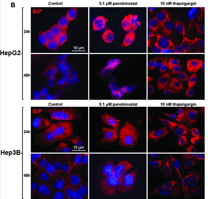 Panobinostat (LBH589) | HDAC inhibitor | Mechanism | Concentration