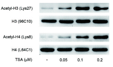 TSA (Trichostatin A) HDAC Inhibitor | Selleck Chemicals | Mechanism ...