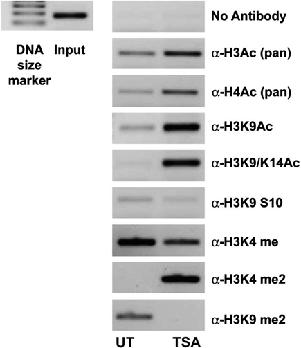 TSA (Trichostatin A) HDAC Inhibitor | Selleck Chemicals | Mechanism ...