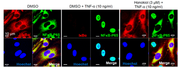 Honokiol | Antineoplastic and Immunosuppressive Antibiotics inhibitor ...