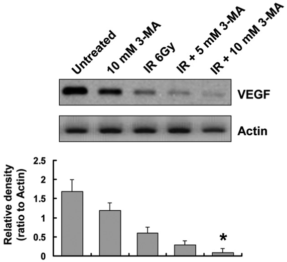 3-Methyladenine (3-MA) Autophagy/PI3K Inhibitor | Selleck Chemicals ...