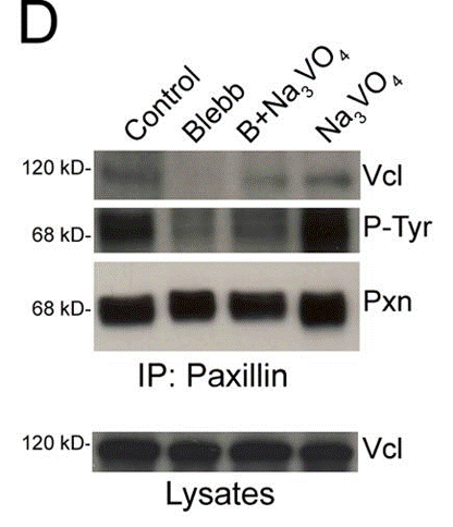 Blebbistatin Myosin II ATPase Inhibitor | Selleck Chemicals
