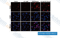 Bromodeoxyuridine (BrdU) | ≥99%(HPLC) | Selleck | DNA/RNA Synthesis ...