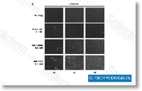 Fedratinib (SAR302503, TG101348) | JAK inhibitor | Read Reviews ...