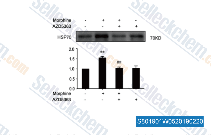 Capivasertib (AZD5363) | Akt inhibitor | Read Reviews & Product Use ...