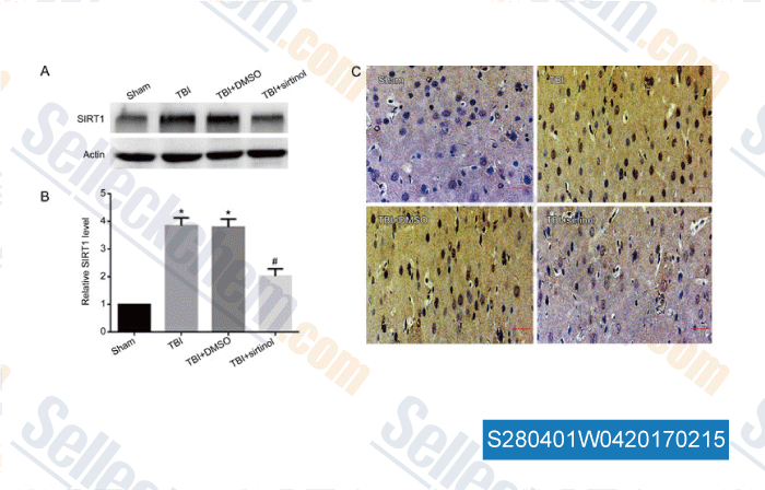 Sirtuin Activation | SIRT1 Inhibition | SIRT1 Inhibitor Review